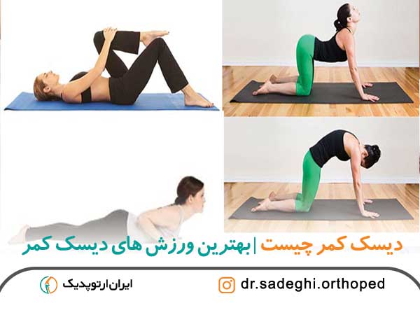 ورزش دیسک کمر چیست 4 تا از بهترین ورزش ها